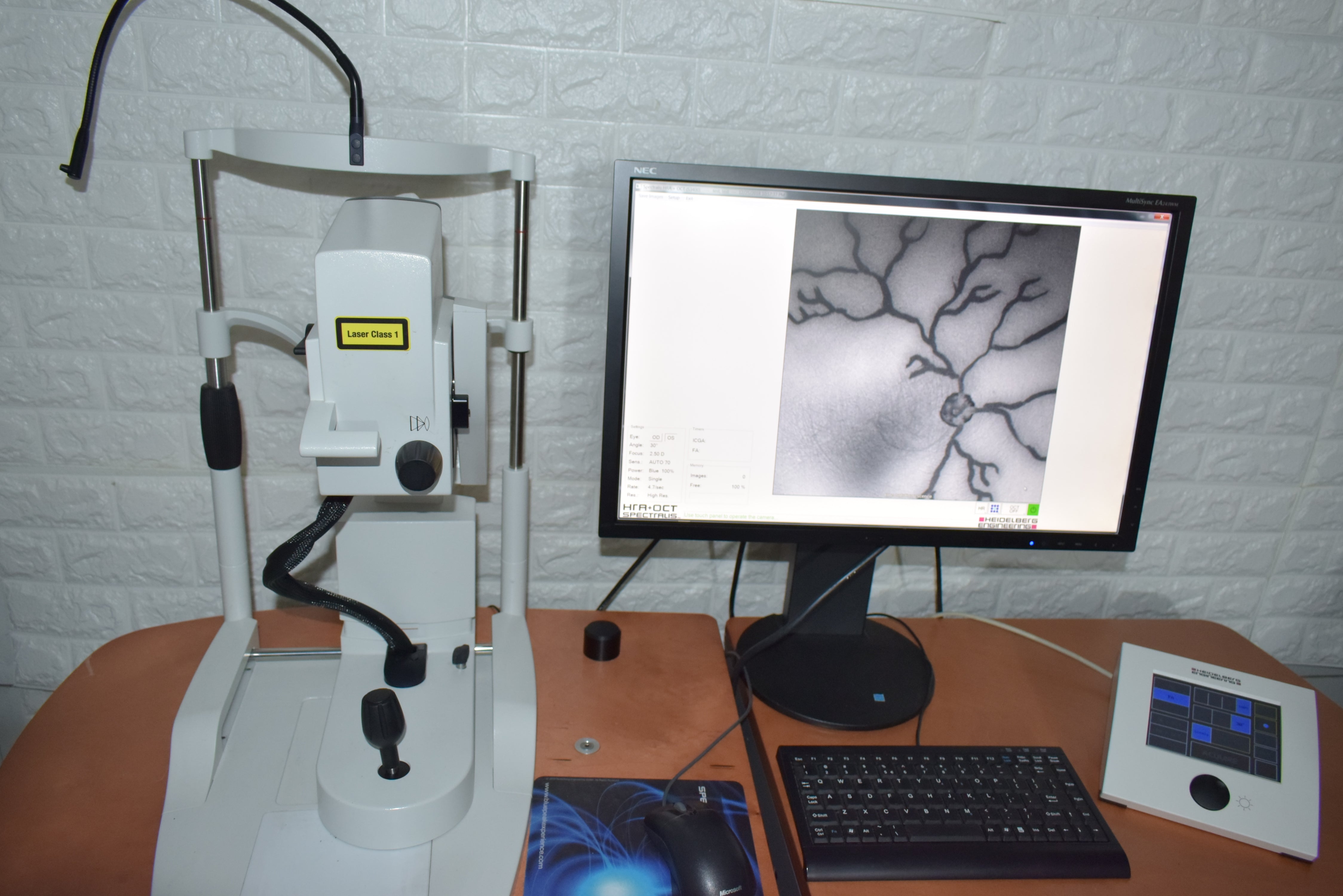 Optical Coherence Tomography (OCT) Equipment - Visume