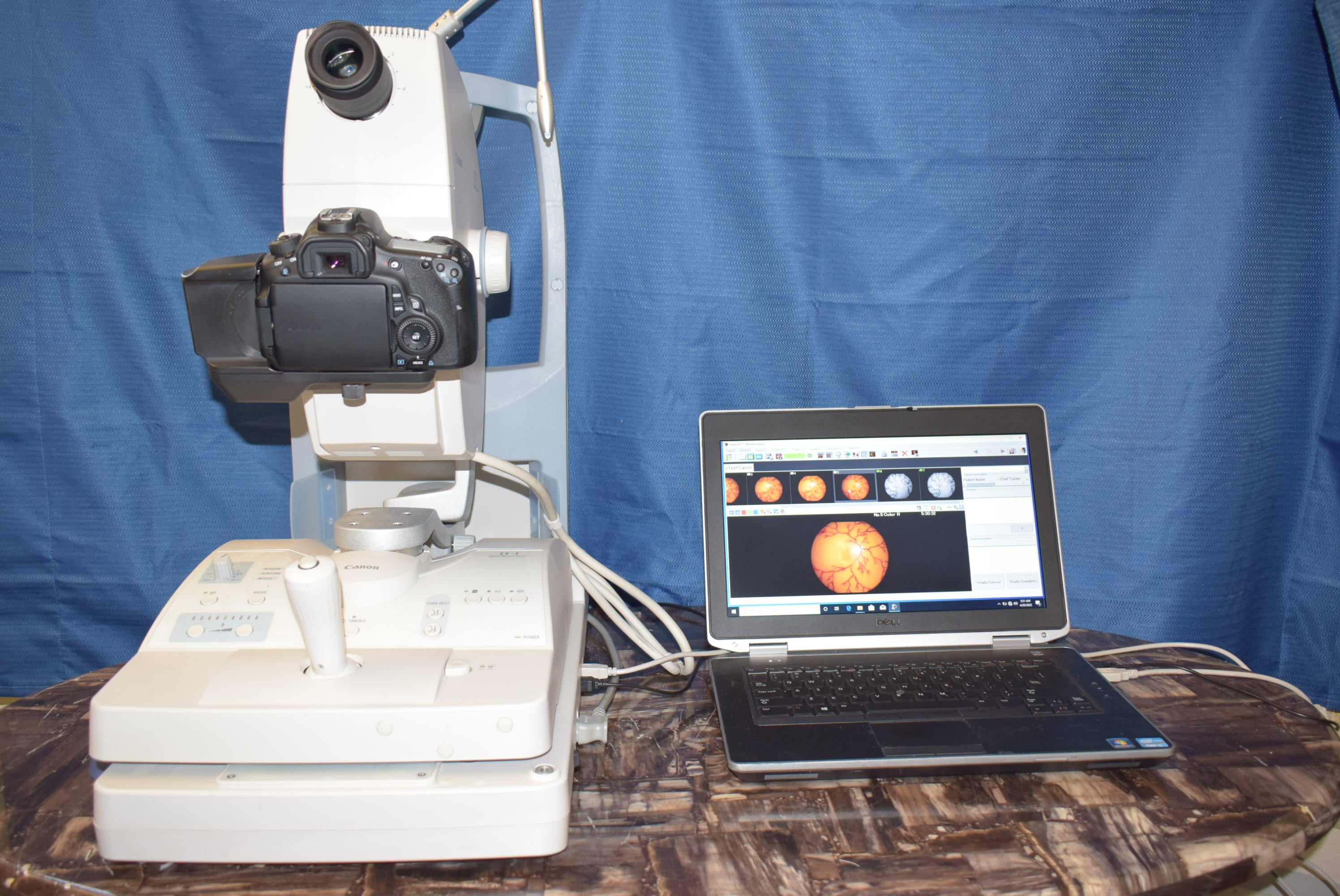 High-Quality Retinal Camera for Accurate Eye Diagnosis