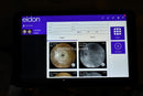 iCare Centervue Eidon AF Fundus Camera - True Color