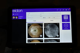 iCare Centervue Eidon AF Fundus Camera - True Color