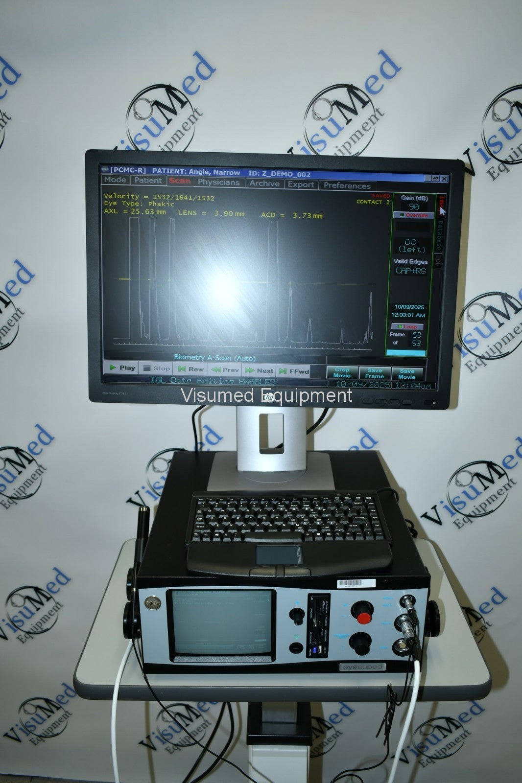 Ellex Eyecubed V3 A scan Bscan Eye Cubed Ultrasound